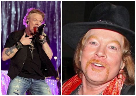 Before And After Celebrity Plastic Surgery Images That Will Make Your