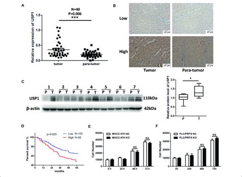 Elevated Expression Of Usp1 In Hcc A Usp1 Mrna Levels In 40 Paired