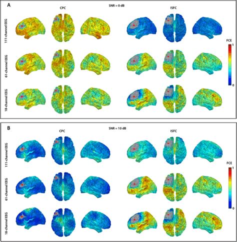Topography Of Functional Connectivity Error Fce For Cpc And Isfc