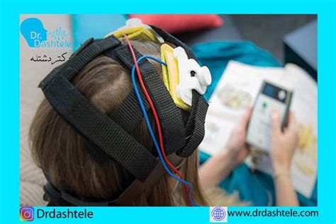 تحریک الکتریکی مغز دکتر دشتله