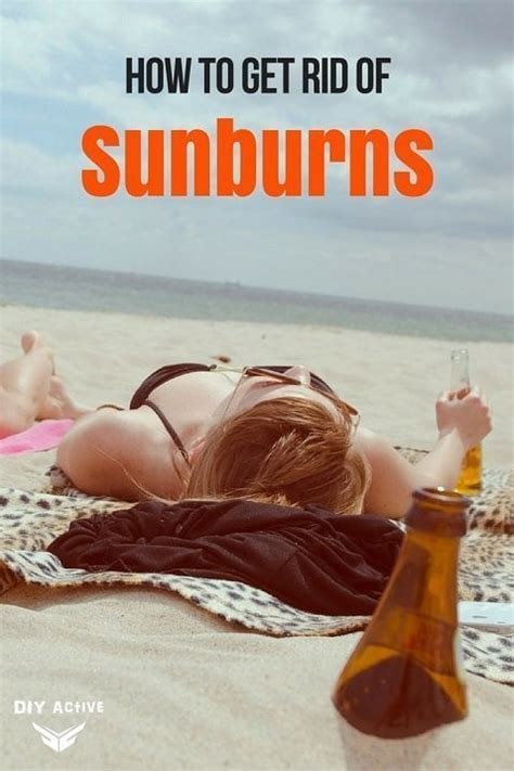 The 5 Best Home Remedies For Sunburn That Work Diy Active