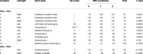 Brain Regions With Significantly Different Reho Values Between The Cus