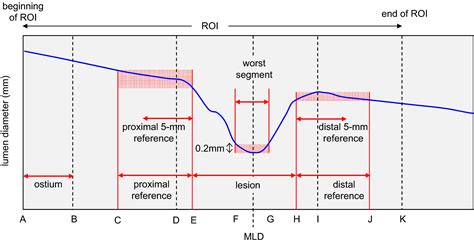 angiography‐based machine learning for predicting