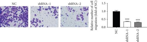 Effect Of Downregulation Of Circrnf13 Expression On The Migration And