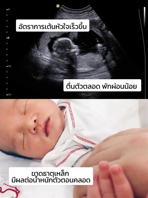 🤔ปัญหาคาใจ ☕️แม่ท้องดื่มกาแฟแล้วอันตรายมั้ย แกลเลอรีที่โพสต์โดย Mama