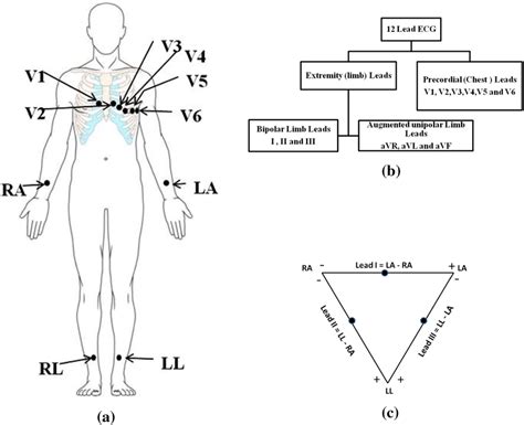 A Electrode Placement In 12 Lead System B 12 Lead Ecg C Einthovens