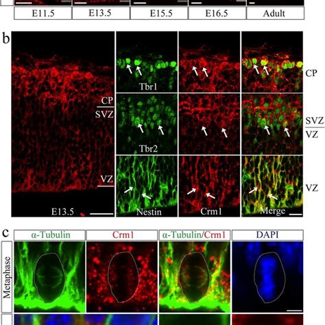 Crm1 Is Expressed In The Developing Cerebral Cortex A Brain Sections