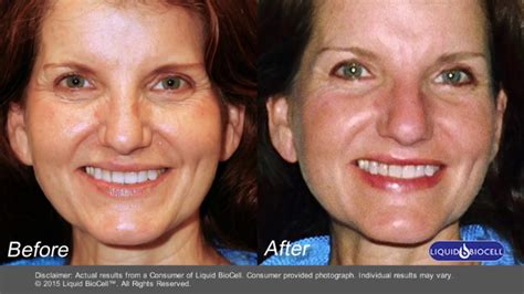 Modere Collagen Sciences Before And After Photos Liquid Biocell Youtube