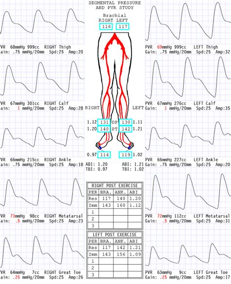 Non Invasive Physiologic Testing The Society For Vascular Medicine