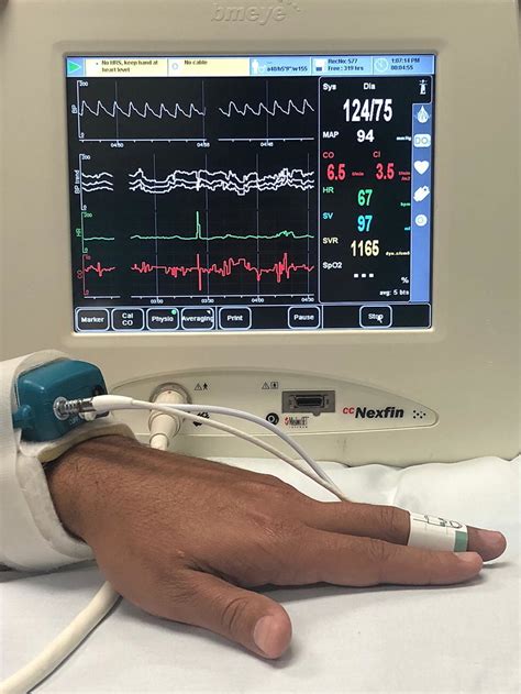 Non Invasive Hemodynamic Monitoring System