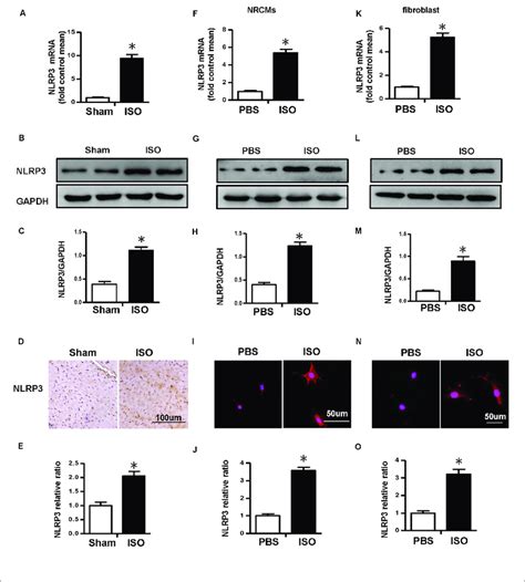 Nucleotide Binding Oligomerization Domain Like Receptor 3 Nlrp3 Was