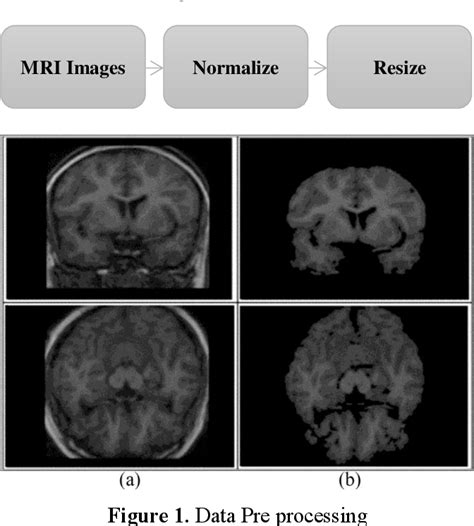 Figure 1 From Brain Tumors Classification Using Convolutional Neural