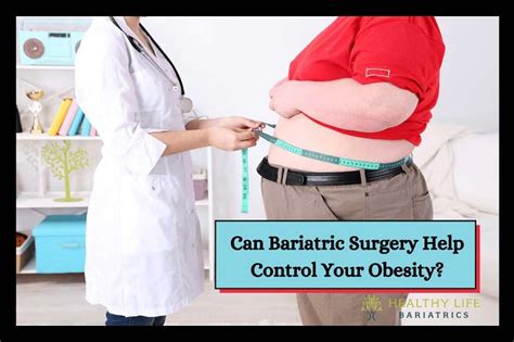 Obesity Control With Bariatric Surgery In Los Angeles Ca Hlb
