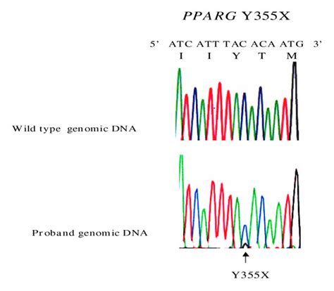 Genomic Dna Sequence Electropherograms Of Heterozygous Pparg Mutation