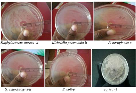 Antimicrobial Activity Of Silver Nanoparticles Against Bacterial