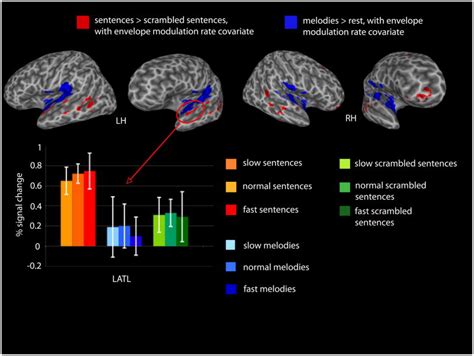 functional anatomy of language and neural organization of speech