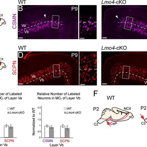 Lmo4 Is Required For Cortico Brainstem Motor Neuron Development In The