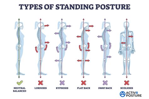 What Types Of Posture Therapy Exercises Will Really Help Me