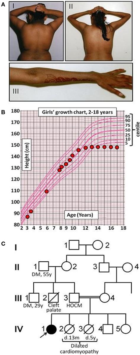 serum sex hormone binding globulin female olyloputy