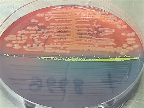 Micrococcus Luteus Introduction Morphology Pathogenicity Lab