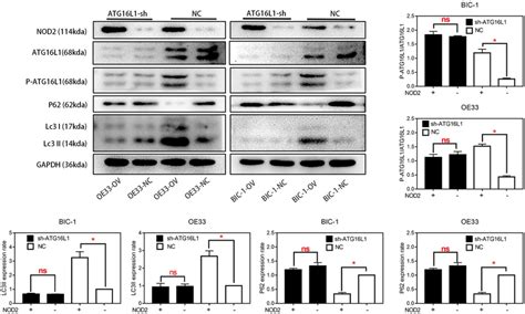The Effect Of Nod2 Overexpression On Autophagy Inhibited The