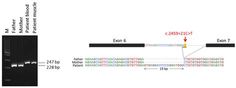 Ijms Free Full Text Differences In Expression Of Iqsec2 Transcript