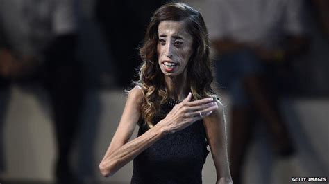 Lizzie Velasquez Online Bullies Called Me The Worlds Ugliest Woman