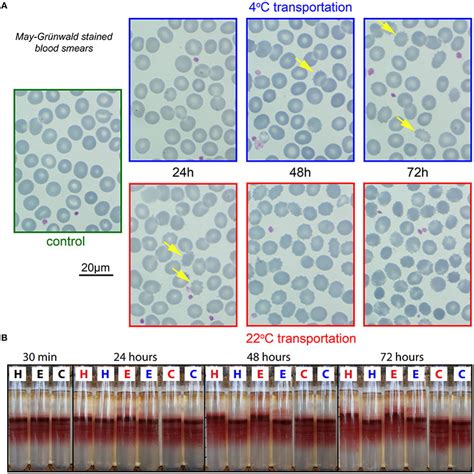 Morphological Analysis And Percoll Centrifugation A Representative