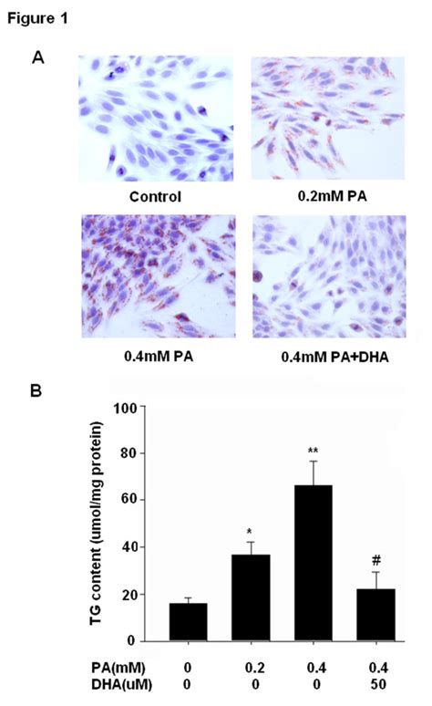 Dha Suppresses Pa Induced Lipids Accumulation In Hepg2 Cells A