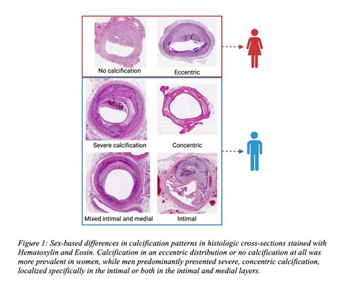 Scvs Scvs Variations In Lesion Morphology Exploring Sex Based