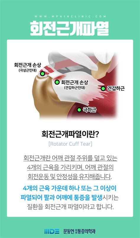 어깨가 너무 아파요 잠을 못 잘 정도 통증 네이버 포스트