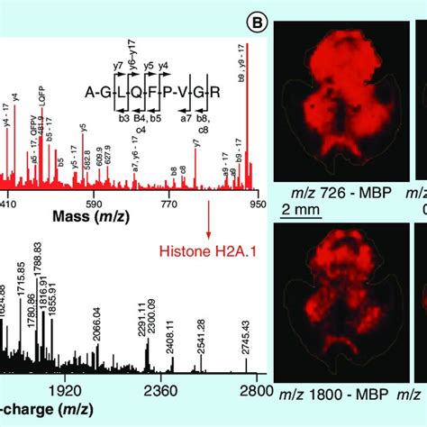Maldi Imaging Of Formalin Fix And Paraffin Embed Tissue Section A