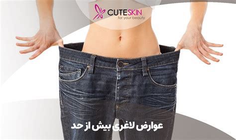 عوارض لاغری بیش از حد؛ خطرات عجیب کمبود وزن کیوت مگ Cuteskin