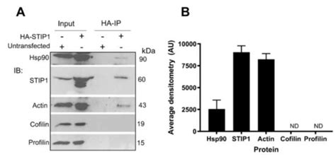 Ijms Free Full Text Stip1 Hop Regulates The Actin Cytoskeleton