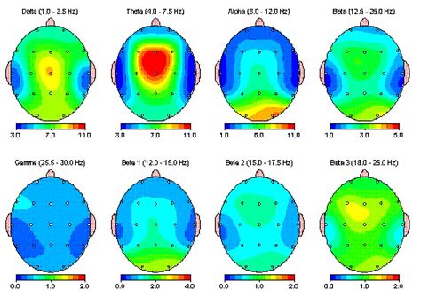 Qeeg Brain Wellness And Neurofeedback Center