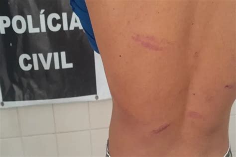 Aluno é Espancado Com Socos Chutes E Pauladas Por Colegas Na Saída Da