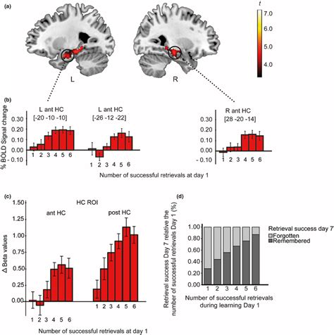 A D Linear Parametric Modulation Effects From The Whole‐brain