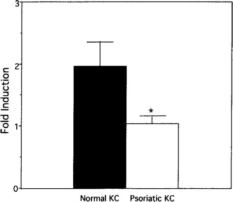Reduction In Irf 1 Induction 5 H After The Addition Of 30 Iu Ml Ifn 30