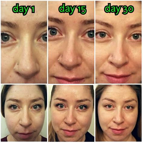 Top 105 Pictures Collagen Powder Before And After Pictures Superb