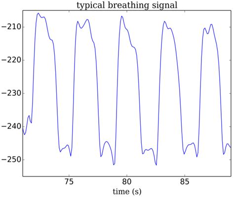 Typical Breathing Signal Versus Time S Arbitrary Unit Download