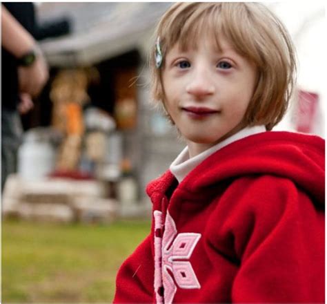 Thumbelina The Girl With Rare Form Of Dwarfism Now Is 12 Years Old