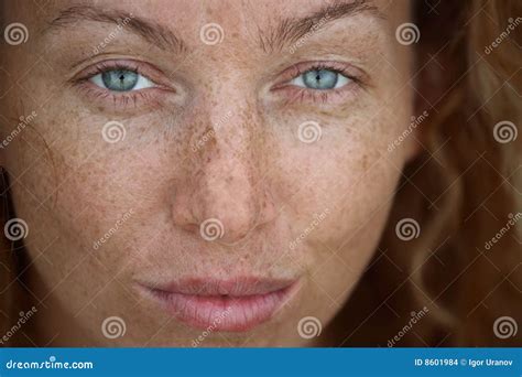 Verticale De La Femme Avec Des Taches De Rousseur Photo Stock Image