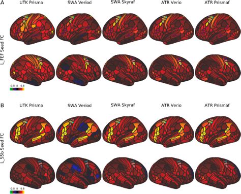 Seed Based Resting State Functional Connectivity In A Single Traveling