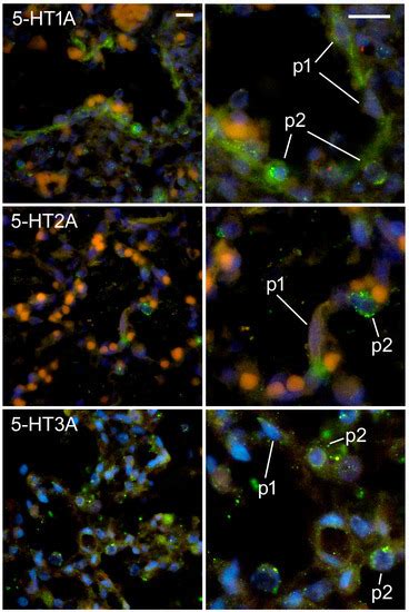 Ijms Free Full Text Expression Patterns Of Serotonin Receptors 5