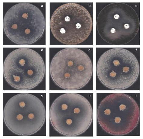 Antifungal Activity Of Streptomyces Sp Strain Bks30 Against Different