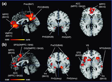 Activated Brain Regions Of Both The Default Mode Network And The Brand