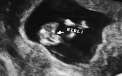 12 week scan gender was determined but really how accurate is it kind