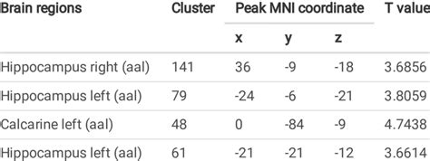 Brain Regions Showing Differences In The Alff Value Between Aki