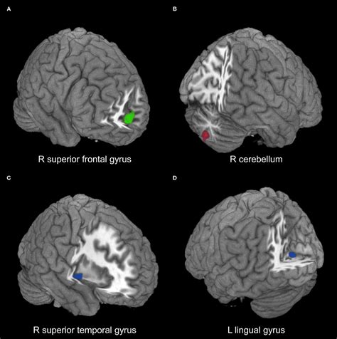 Frontiers Regional Spontaneous Neural Activity Alterations In Type 2