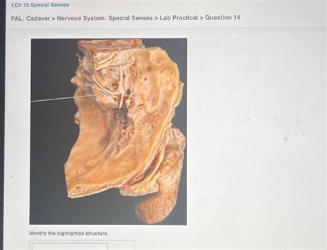 Solved Pal Cadaver Nervous System Special Senses Lab